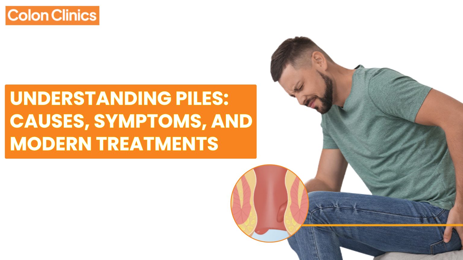 Piles Treatment in Vizag | Symptoms, Causes & Treatment Options - Colon ...